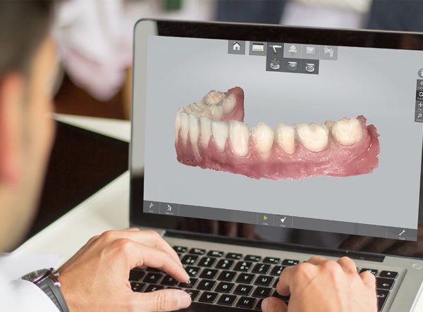 Dental Lab NYC: Ultimate Dental, Denture, Crown & Implants Lab